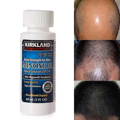 Kirkland Extra Strength for Men Tropical Solution 5% – ROMAC